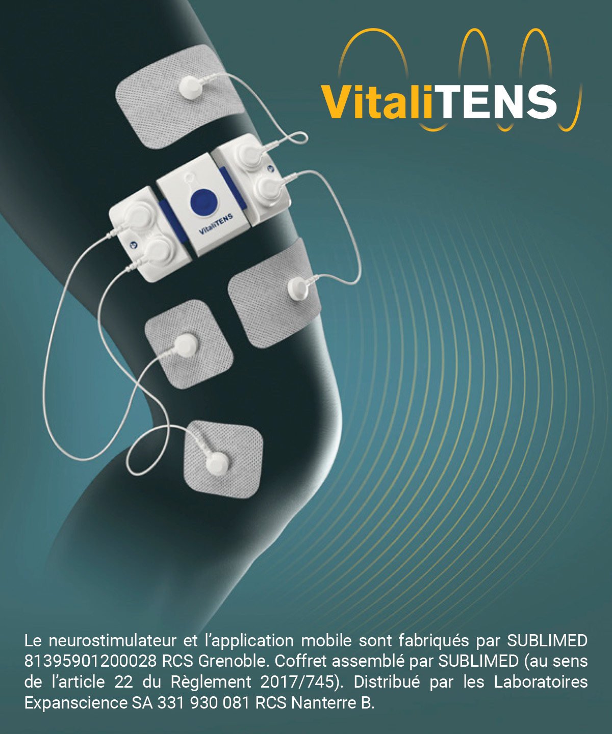 Arthrose du genou : le bénéfice de la Neurostimulation électrique ...